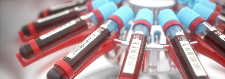 5 reasons why you're always cold - Healthcare Associates of Texas